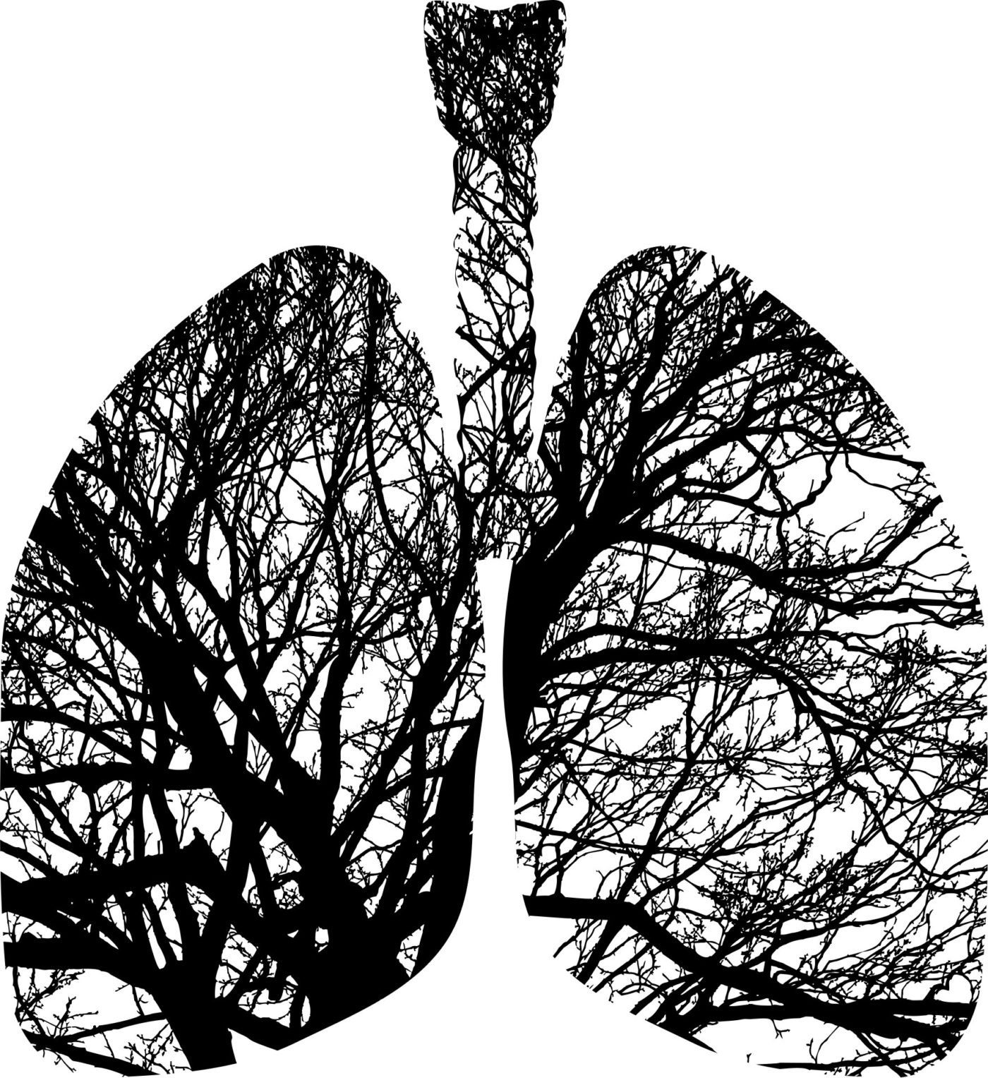 New study reveals lung cell roles in pulmonary immunity - Tech and ...