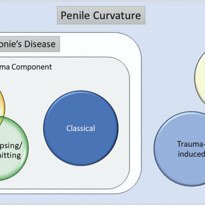 'PTNM' system provides new classification for Peyronie's disease and ...