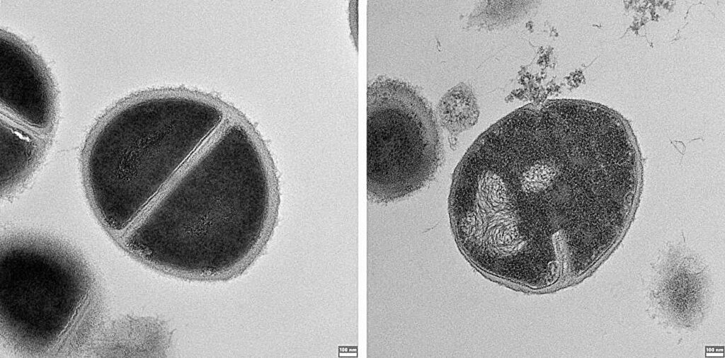 Cellular 'trash' reveals new immune defense mechanism against bacteria ...